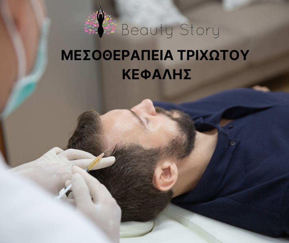 ΜΕΣΟΘΕΡΑΠΕΙΑ ΜΑΛΛΙΩΝ - Beauty Story